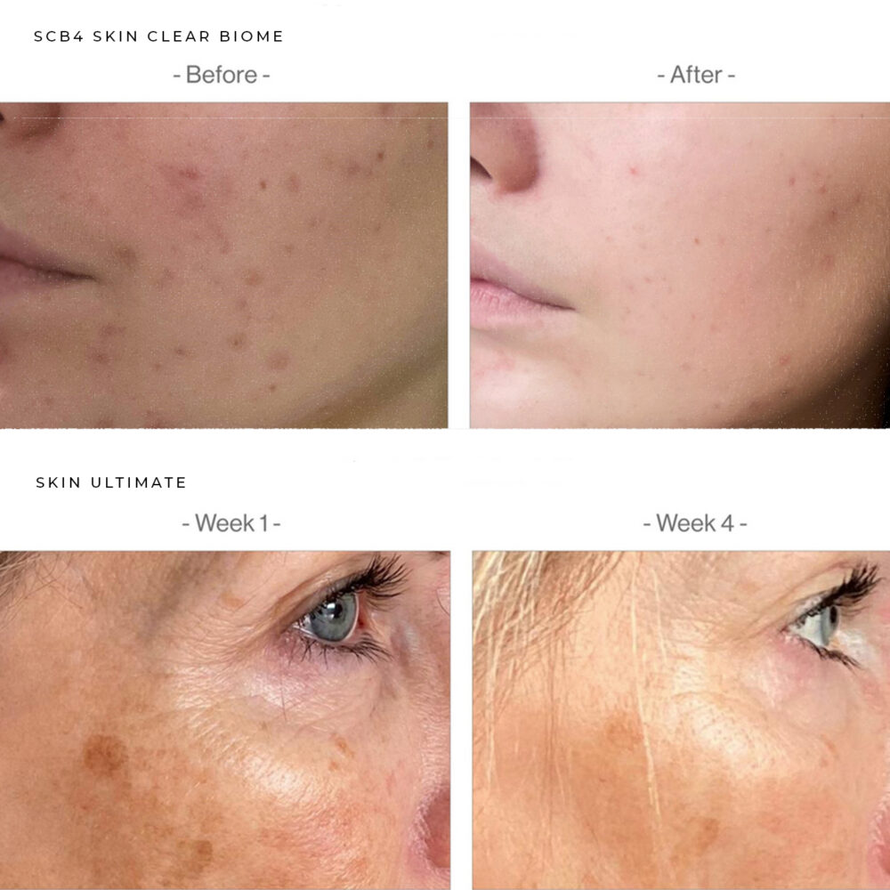 Stogryn | Canadian Distributor of Professional Skin Solutions